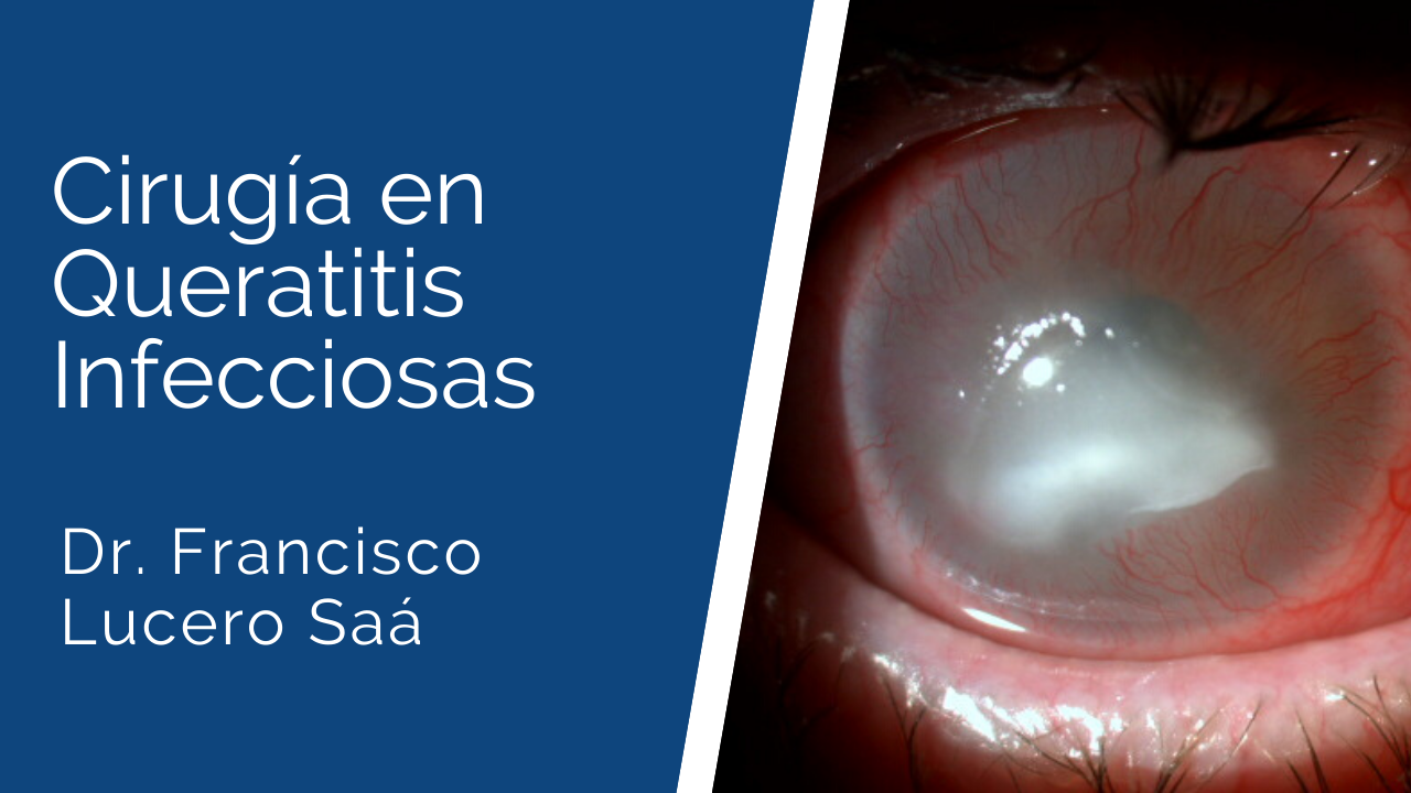 Publicado: 26 Jun 2020